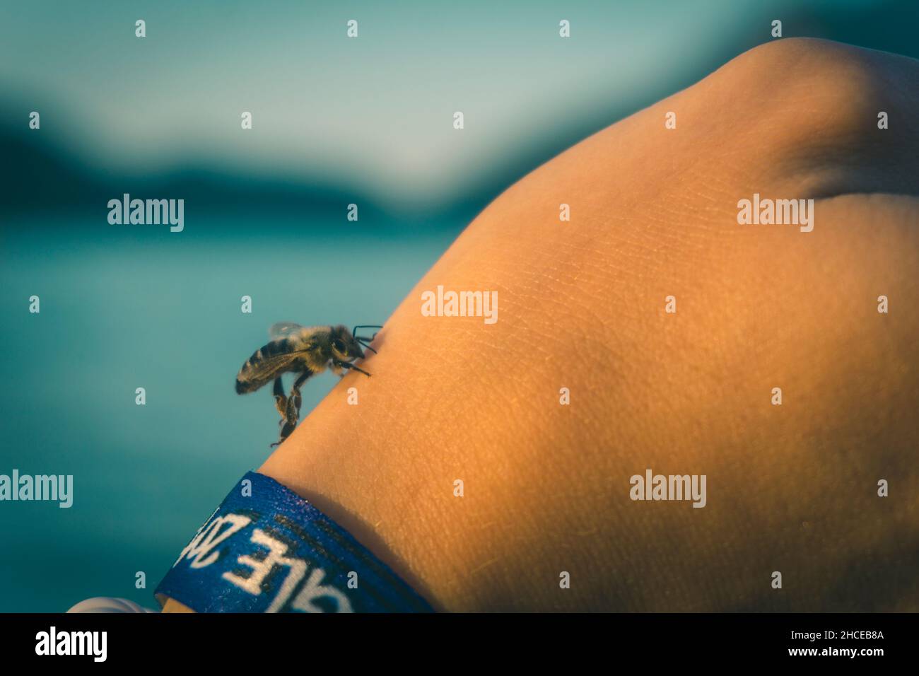 Bee sting hand hi-res stock photography and images - Alamy