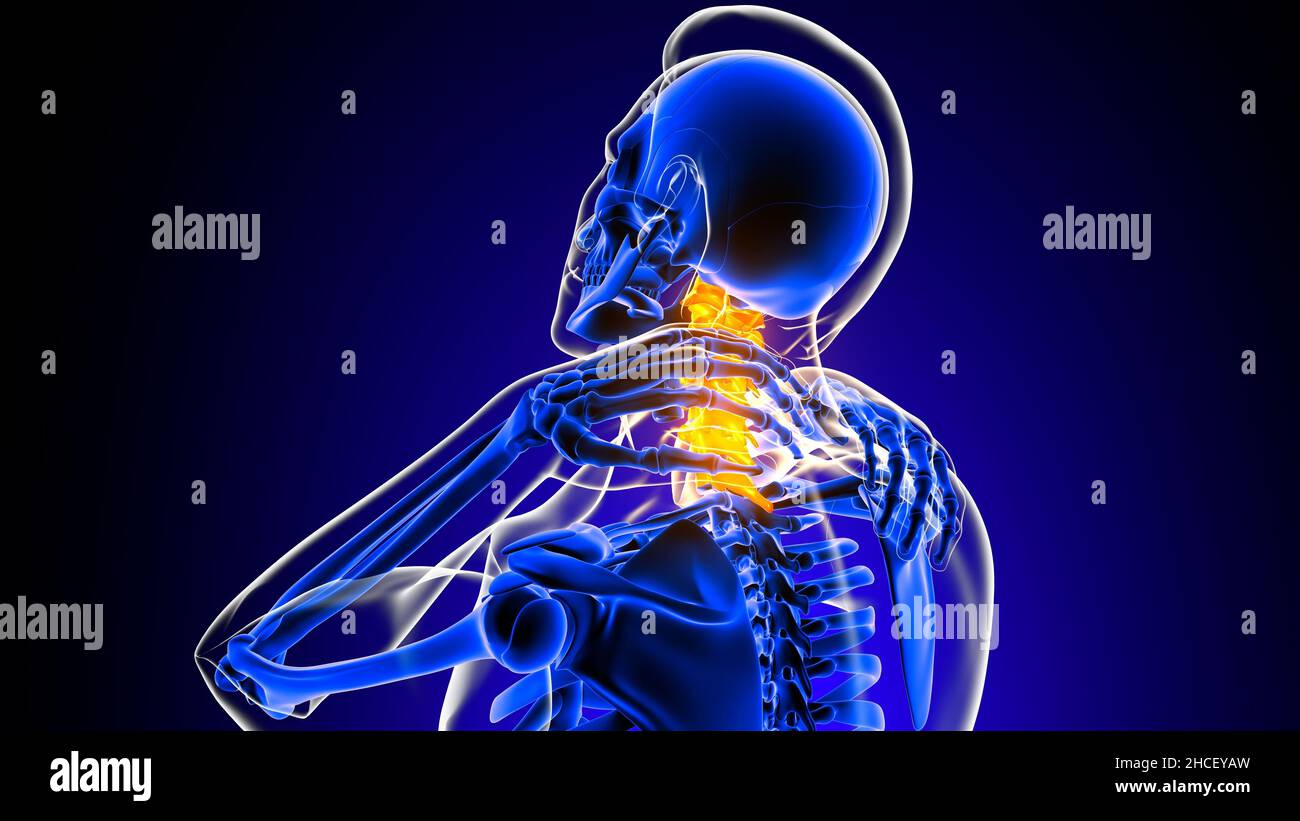 Cervical spine neck joint pain Anatomy For Medical Concept 3D ...