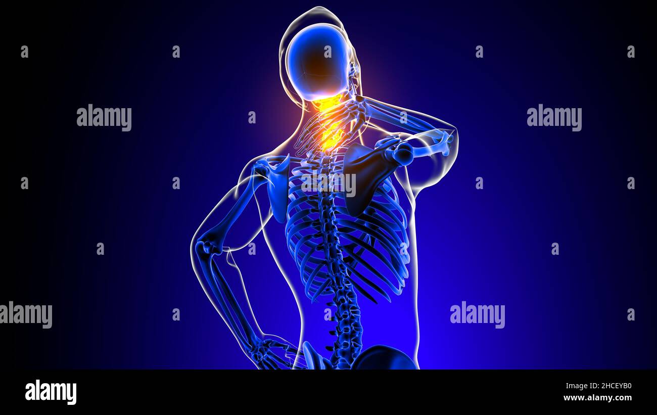 Cervical spine neck joint pain Anatomy For Medical Concept 3D ...