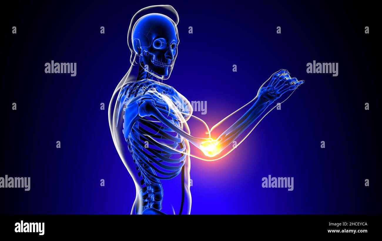 Elbow joint pain Anatomy For Medical Concept 3D Illustration Stock ...