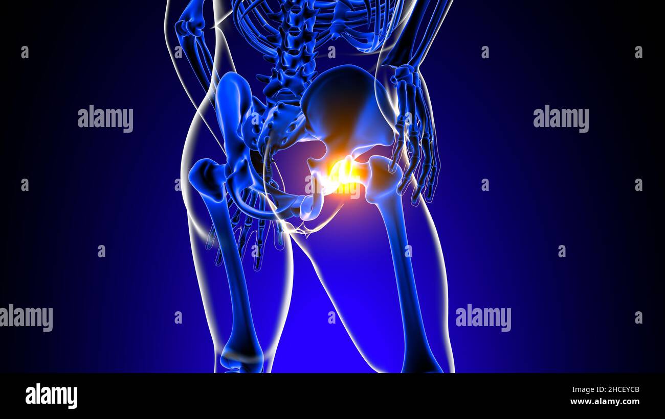Hip joint pain Anatomy For Medical Concept 3D Illustration Stock Photo ...