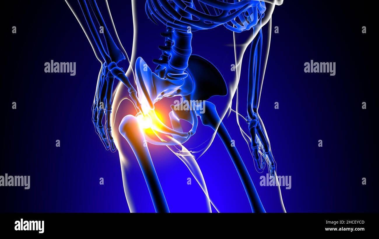 Hip joint pain Anatomy For Medical Concept 3D Illustration Stock Photo ...