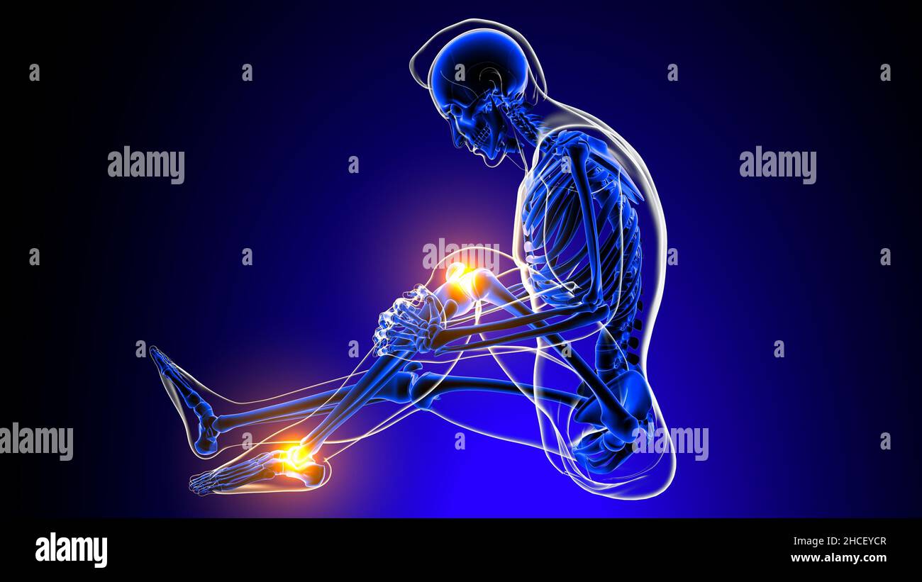 Human skeleton joint pain Anatomy For Medical Concept 3D Illustration ...
