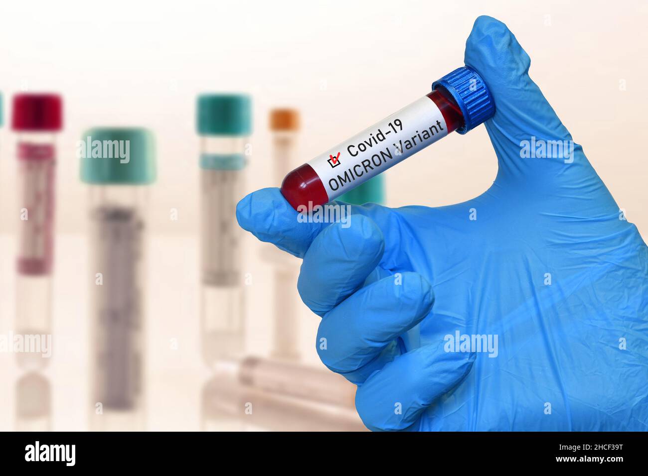 The doctor holds a blood test tube for the detection of the Omicron ...