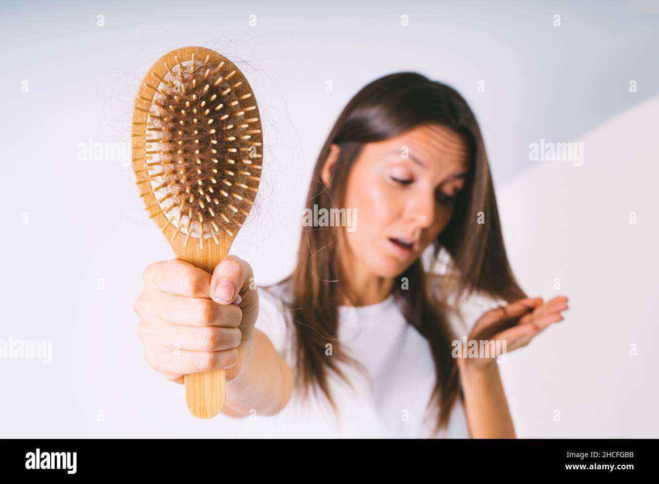 Alopecia hair loss hi-res stock photography and images - Alamy