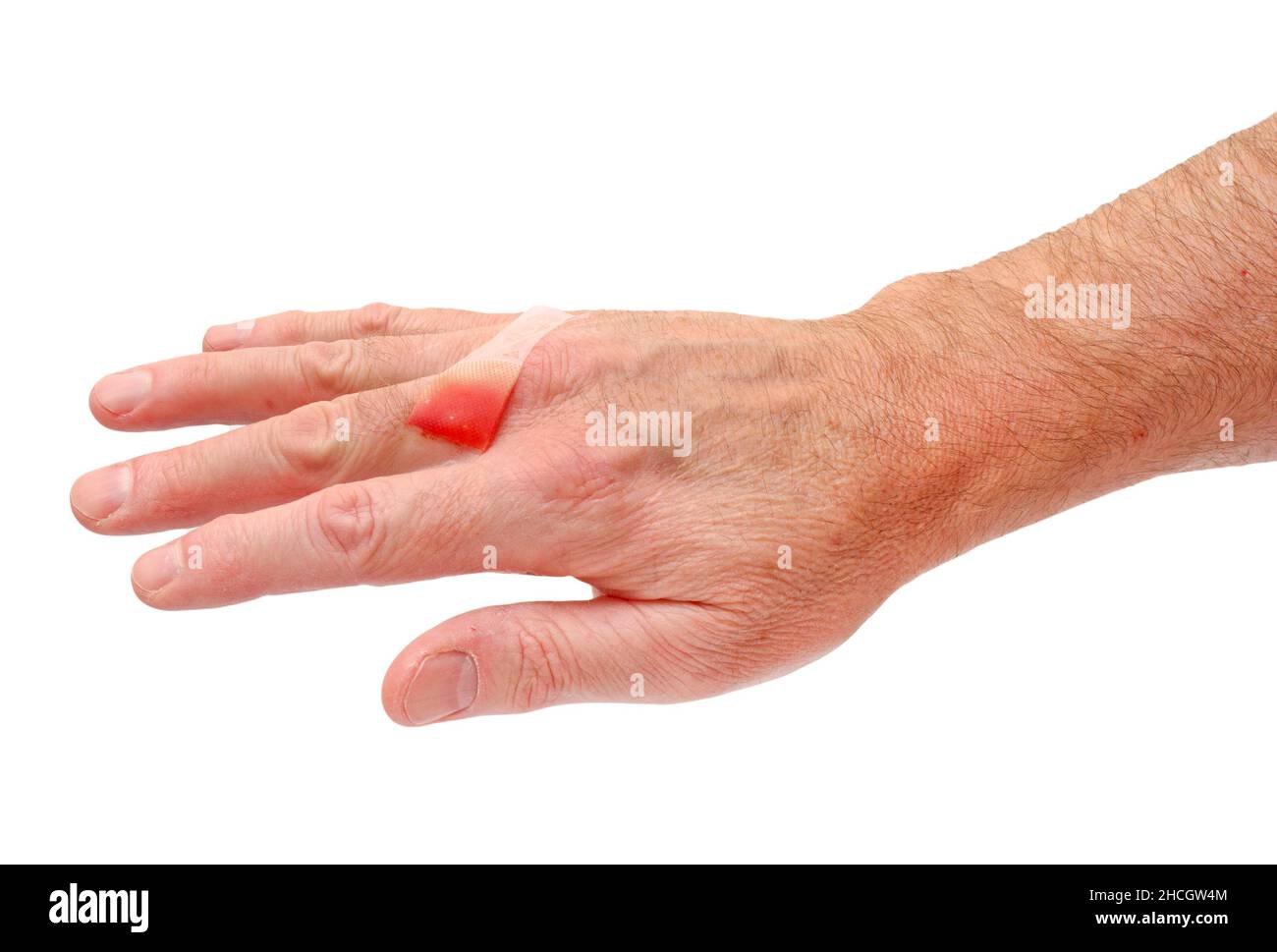 Blood soaked adhesive bandage on hand isolated on white Stock Photo - Alamy