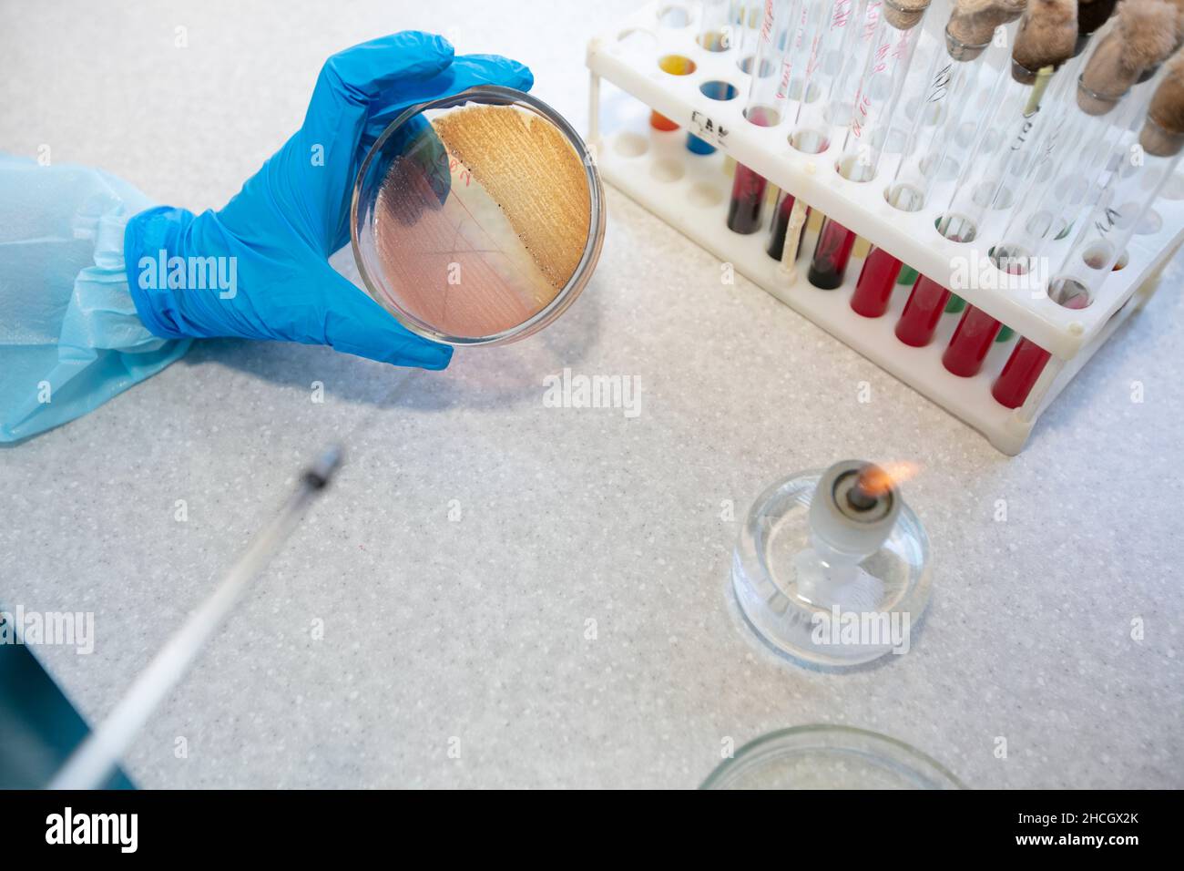 The hands of a physician laboratory assistant in an infectious disease ...