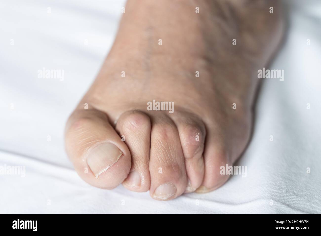 Foot pain old man hi-res stock photography and images - Alamy