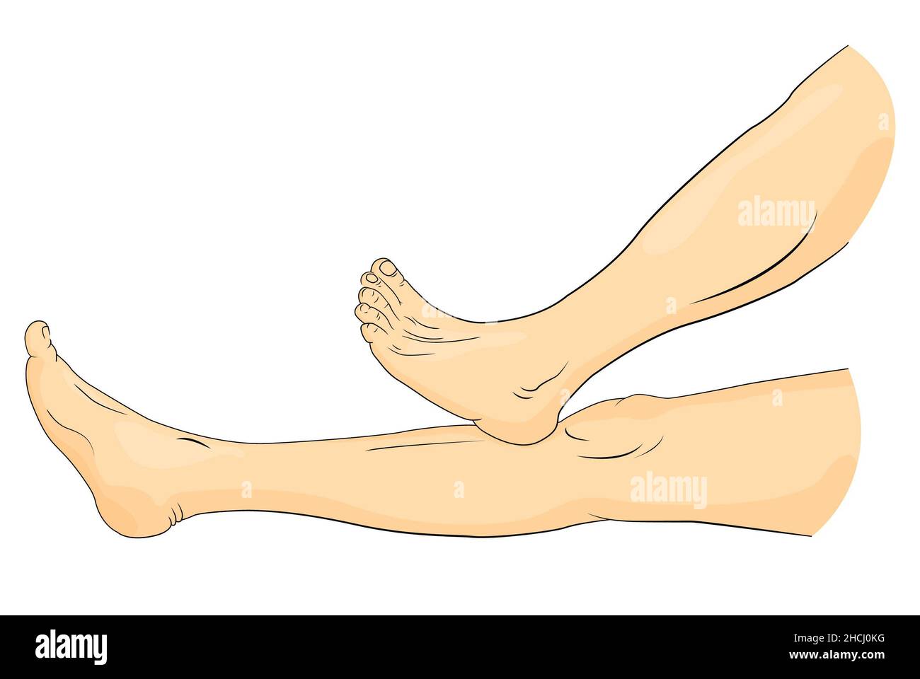 Heel to shin test, neurological coordination testing. Neurological exam ...