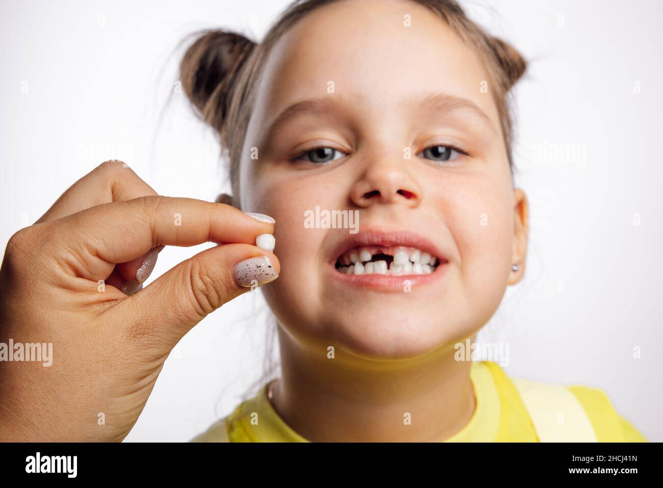 Hand holding torn out baby tooth with little girl face looking at ...
