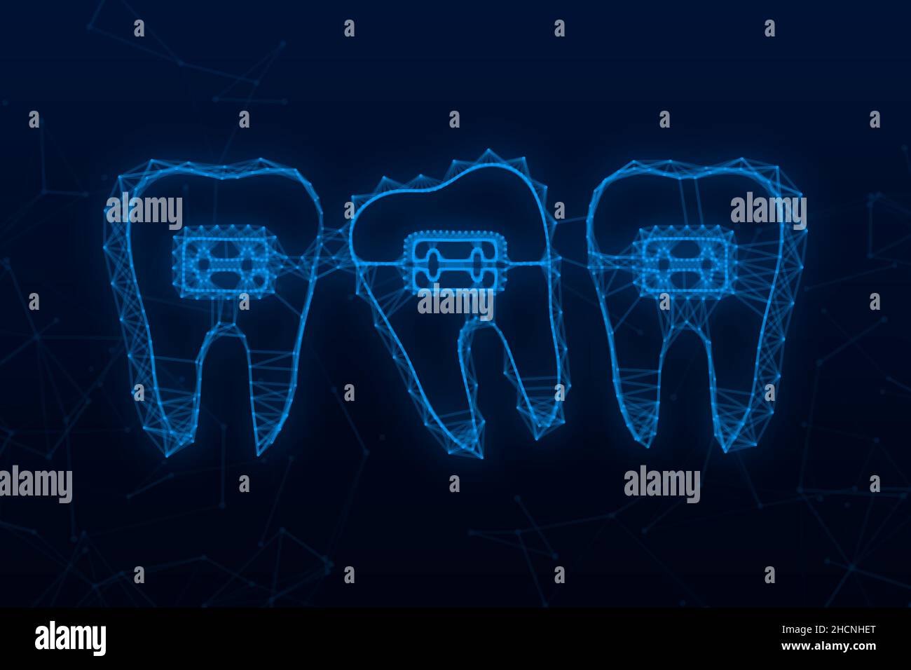 Correction of teeth with orthodontic braces. Stages of teeth alignment ...