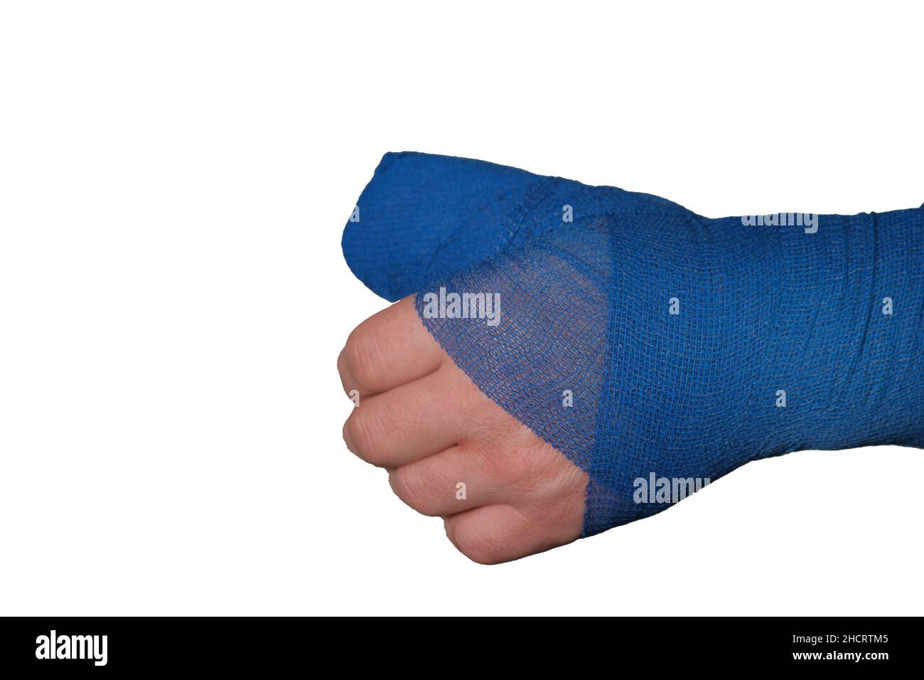 Bandaged hand isolated on white background.Broken arm. Blue surgical ...