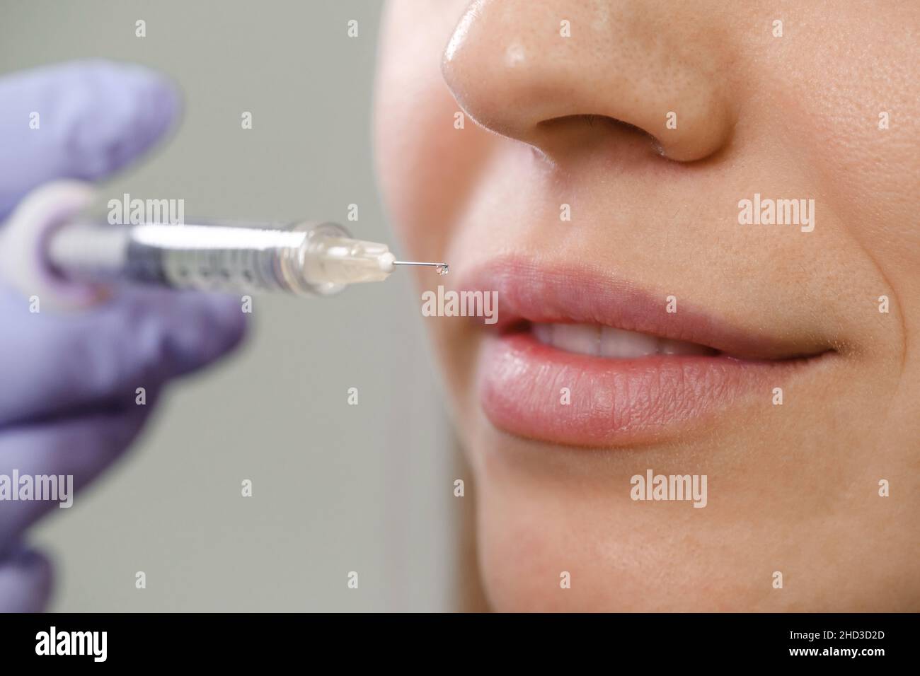 Injection lip hi-res stock photography and images - Alamy