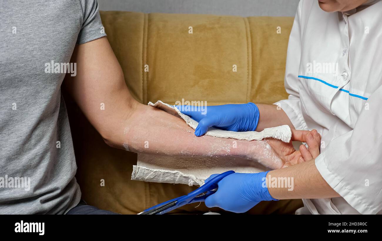 Nurse cuts gypsum bandage from healed arm of young man Stock Photo - Alamy