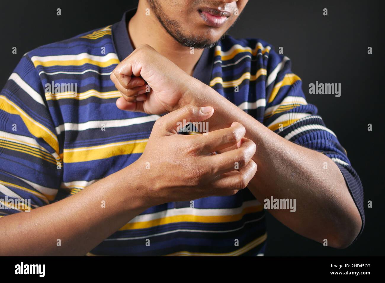 man suffering from itching skin, close up Stock Photo - Alamy