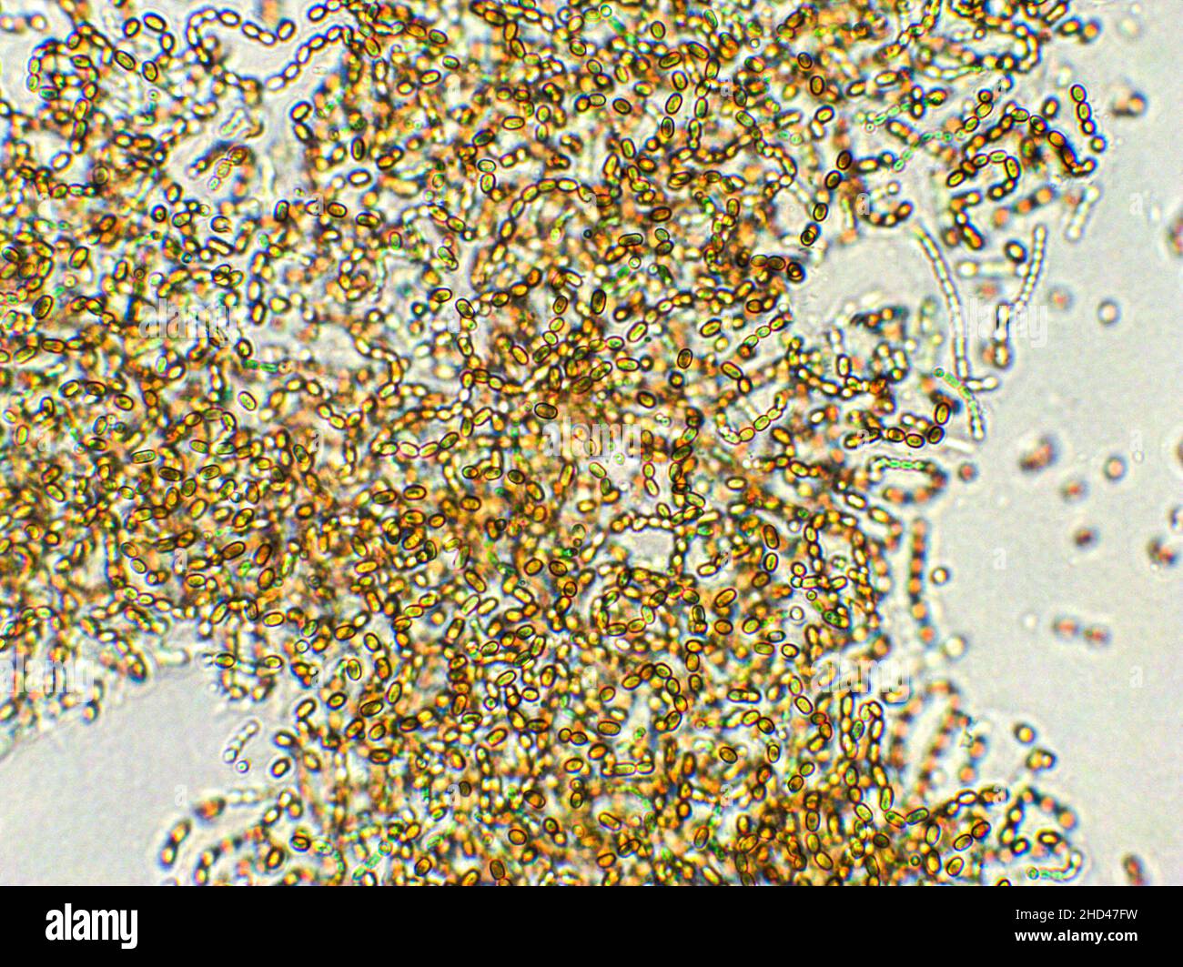 Single cell cyanobacteria hi-res stock photography and images - Alamy