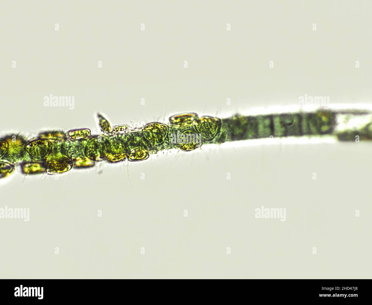 Blue-green filamentous algae under microscopic view, cyanobacteria ...