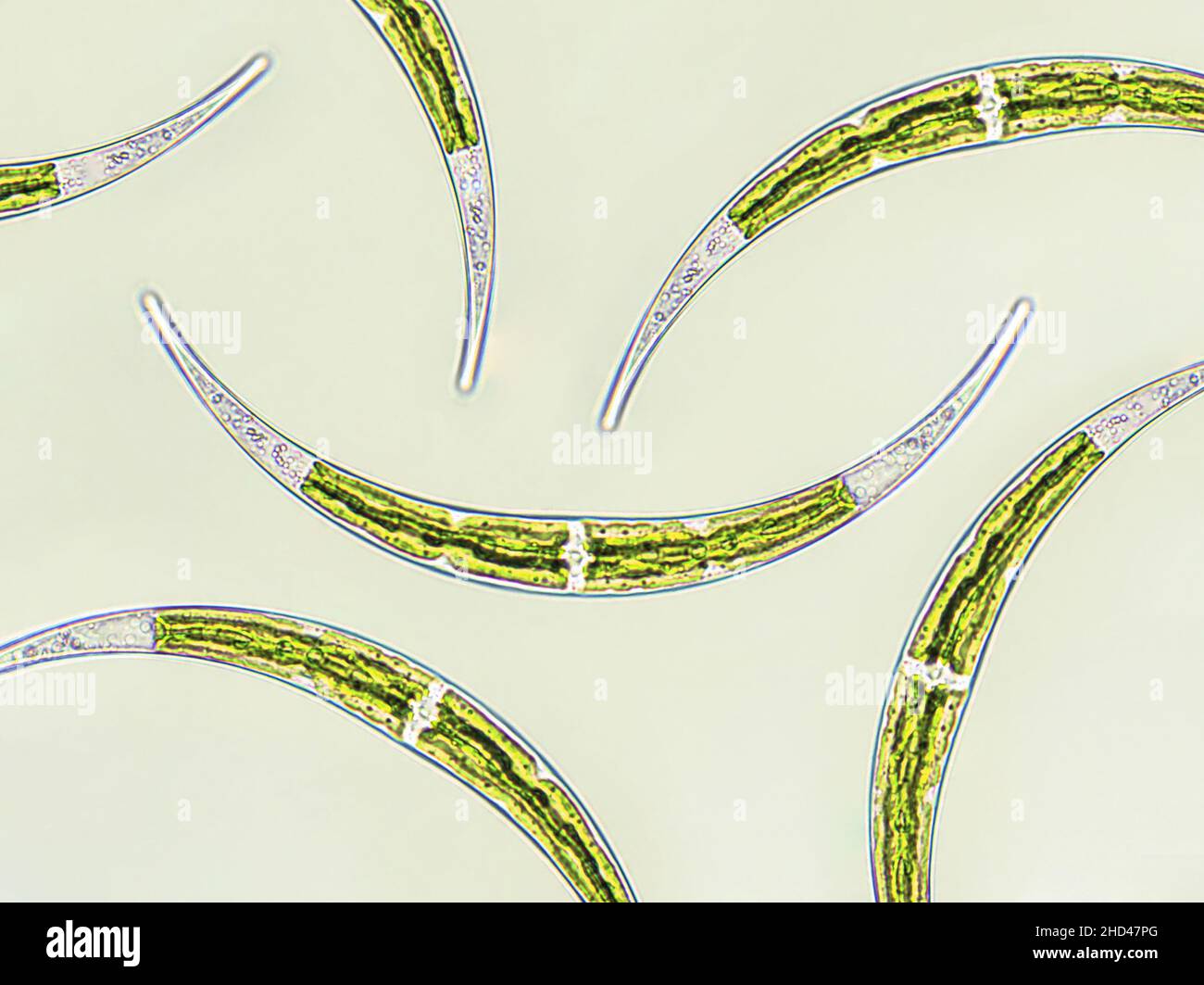 Algae under microscopic view, Closterium, Charophyta, Green algae ...