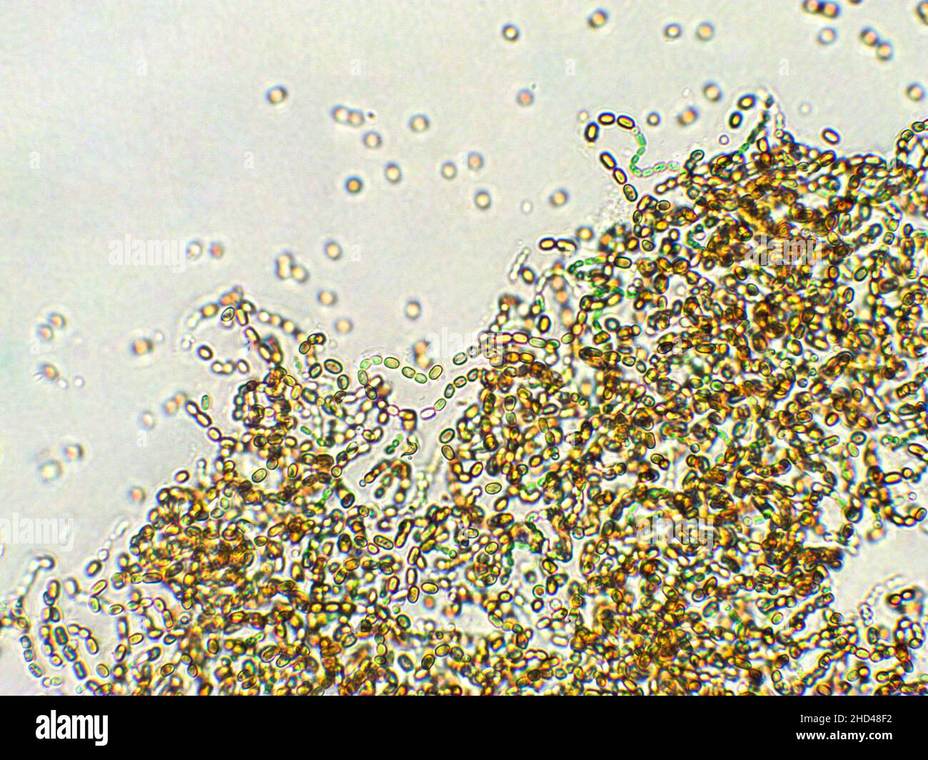 Aphanothece algae under microscopic view, cyanobacteria, blue-green ...