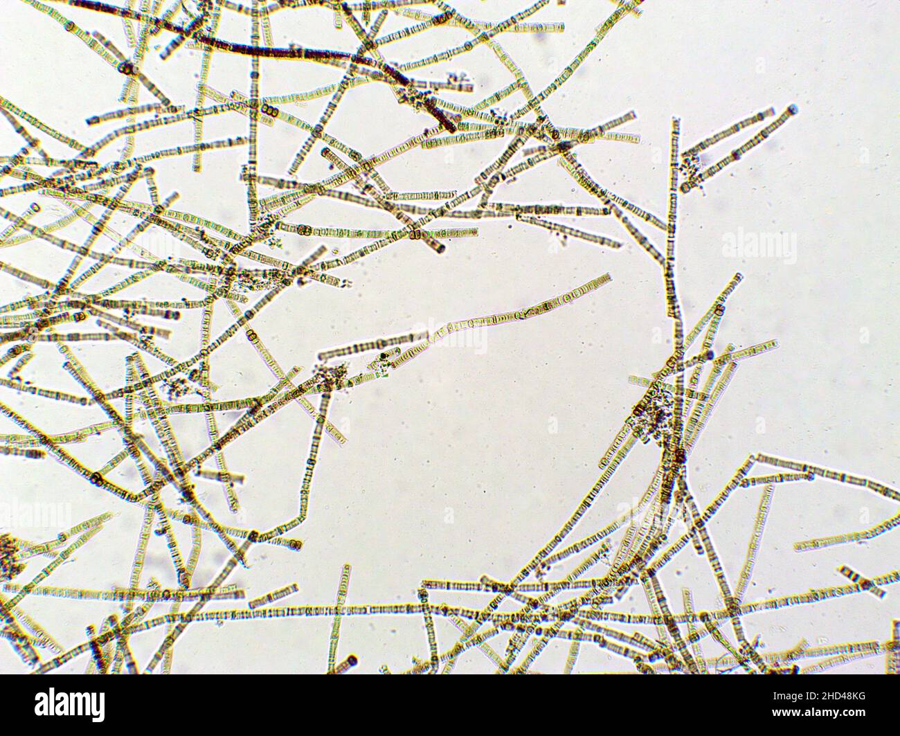 Nodularia algae under microscopic view, nitrogen-fixing cyanobacteria ...