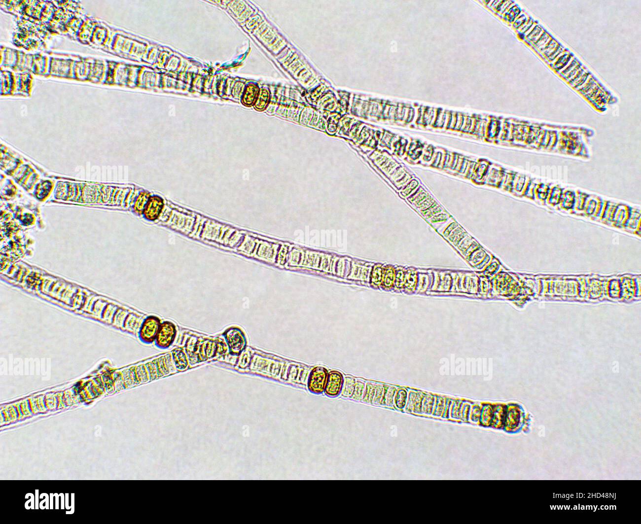 Nodularia algae under microscopic view, nitrogen-fixing cyanobacteria ...