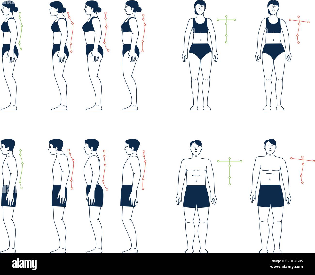 Incorrect posture standing hi-res stock photography and images - Alamy