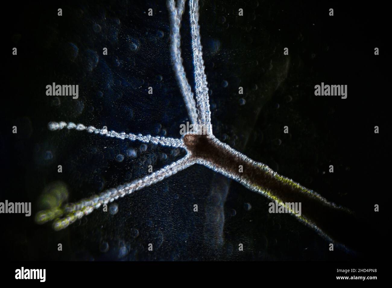Hydra vulgaris on darkfield under a light microscope, freshwater hydra ...