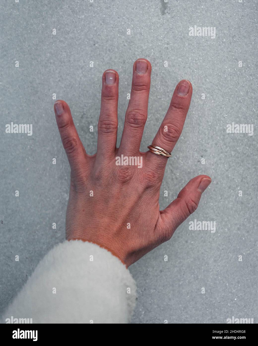 Womans hand laying on ice with a ring on the finger Stock Photo - Alamy