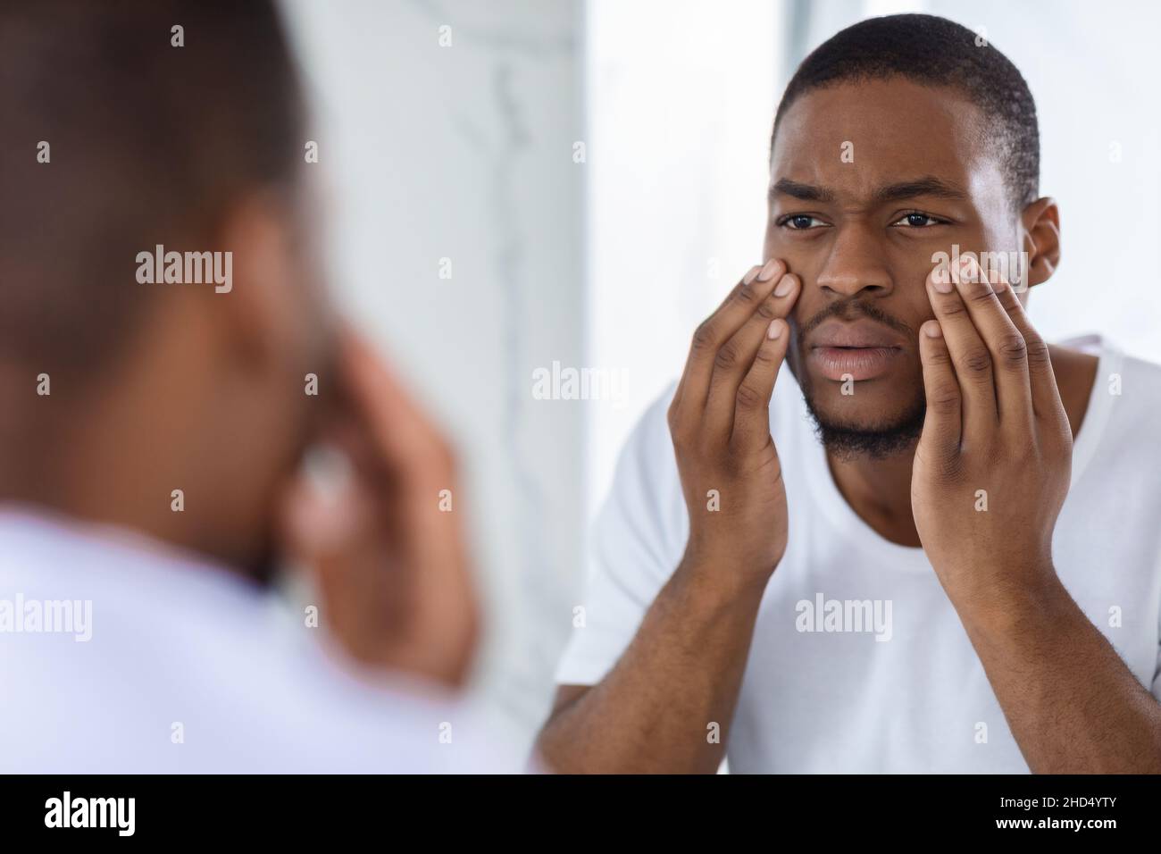 Dull Skin. Worried Young Black Man Looking At Mirror And Touching Face ...