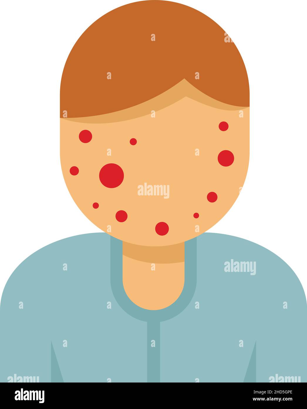 Face measles icon. Flat illustration of face measles vector icon ...