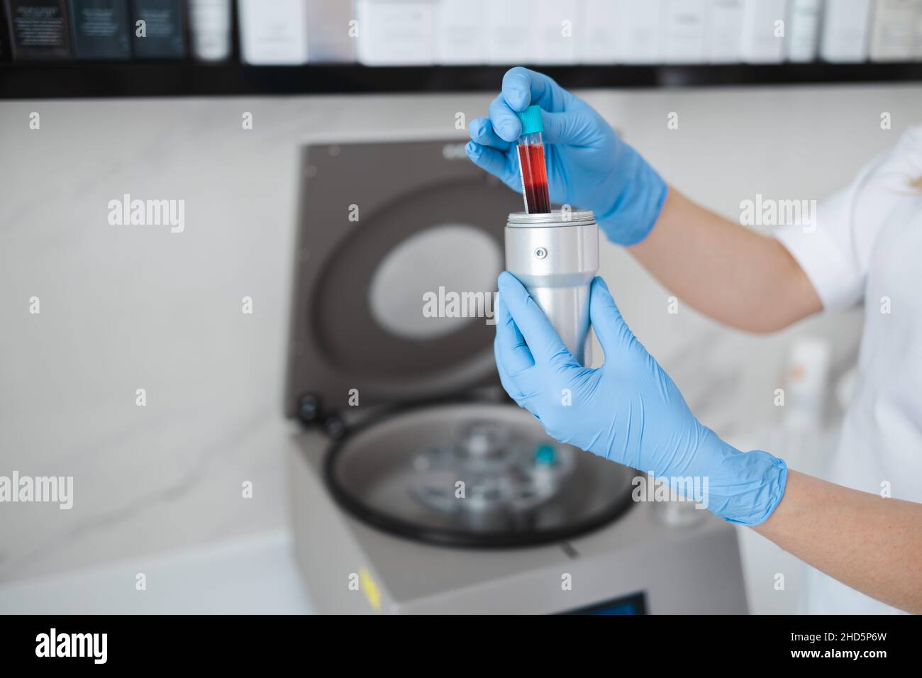 Test tube plasma in hands hi-res stock photography and images - Alamy