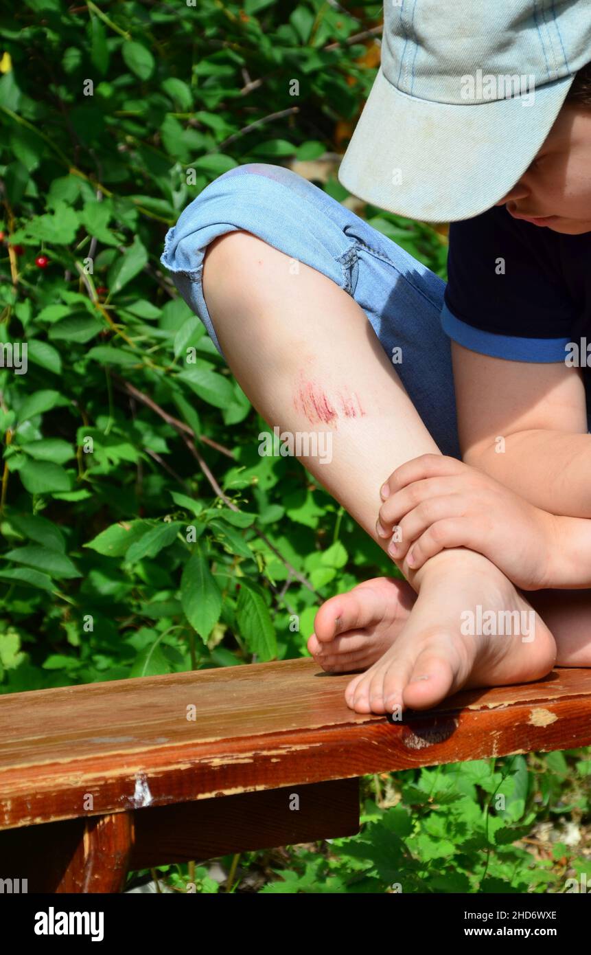 Child graze fall hi-res stock photography and images - Alamy