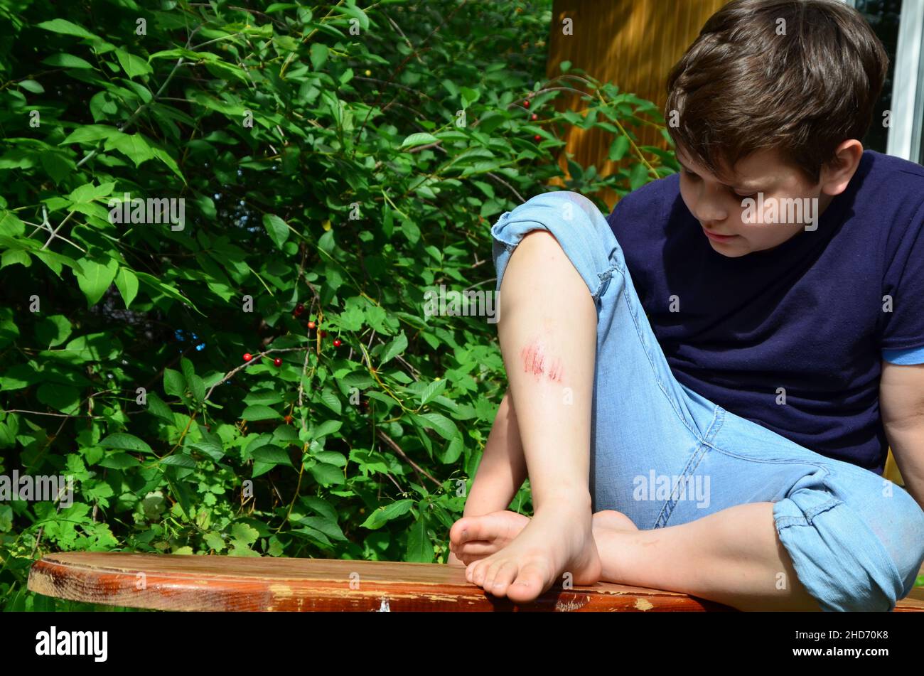 Closeup of injured young kid's knee after he fell down on pavement, the ...