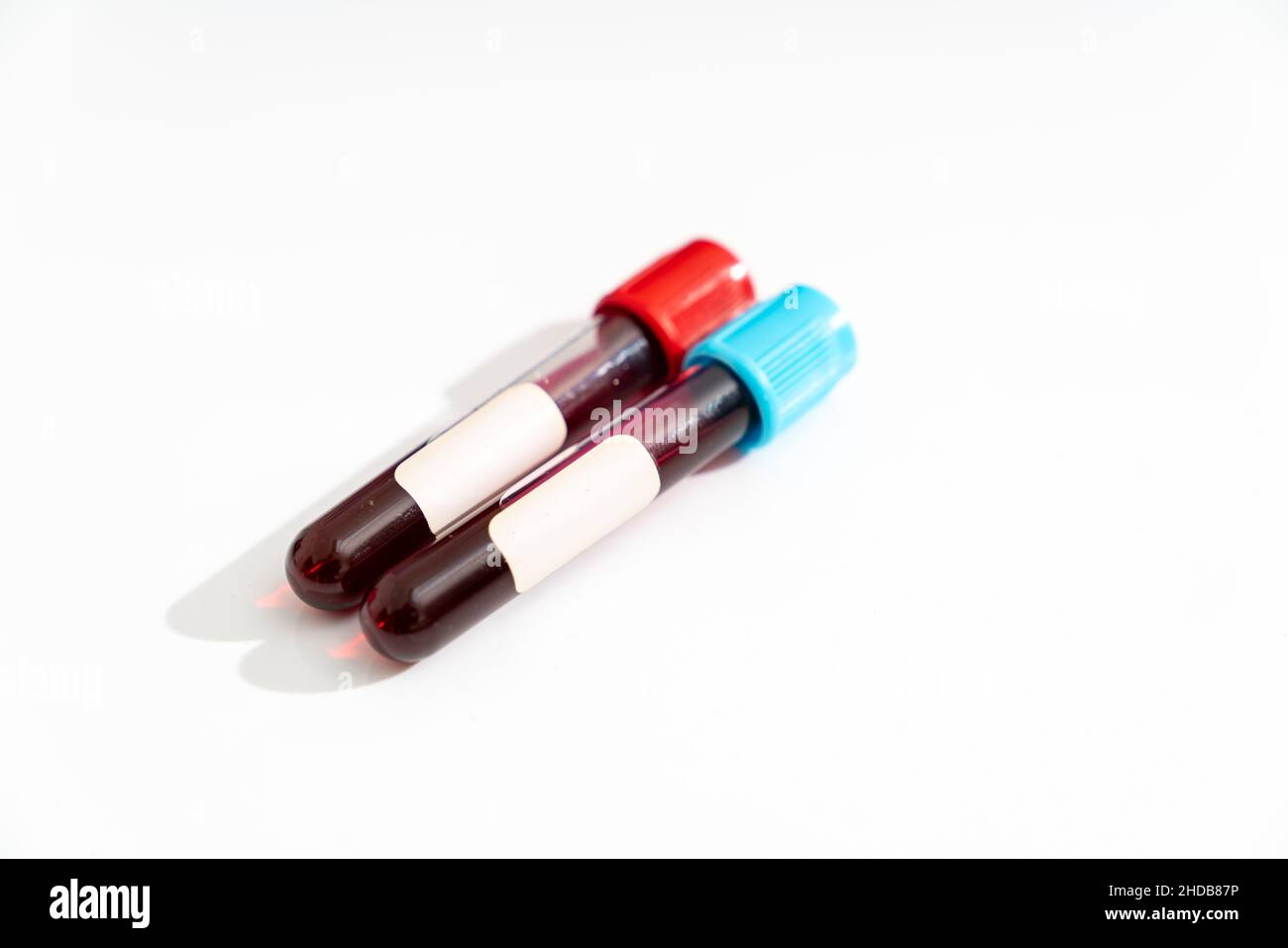 Two Test tube with empty label to biological sample for medical ...