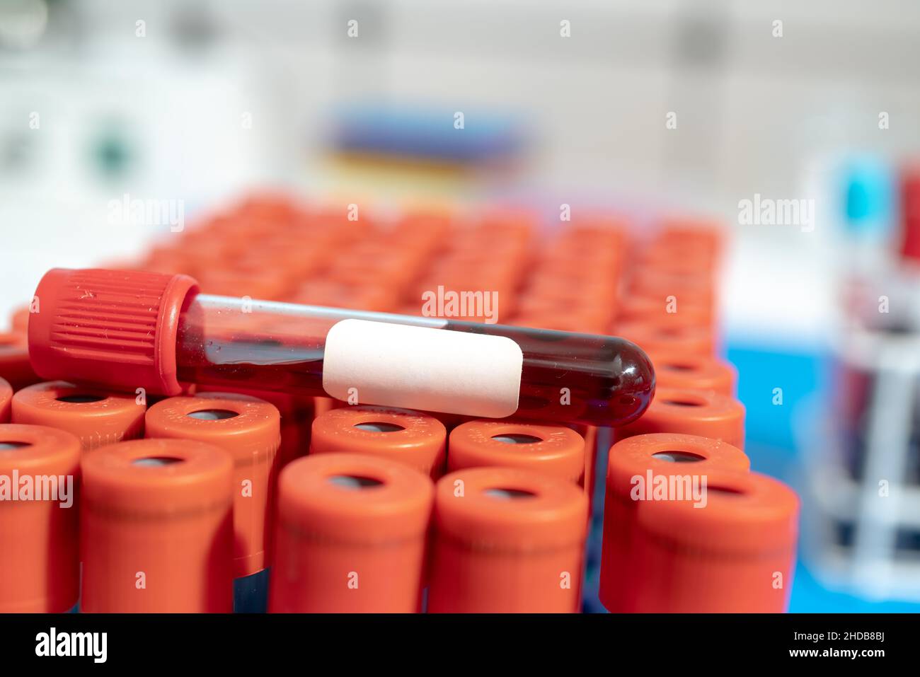 Test tube with empty label to biological sample for medical laboratory ...