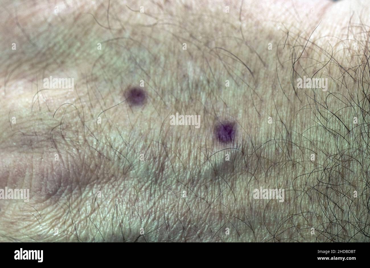 Human skin microscope hi-res stock photography and images - Alamy