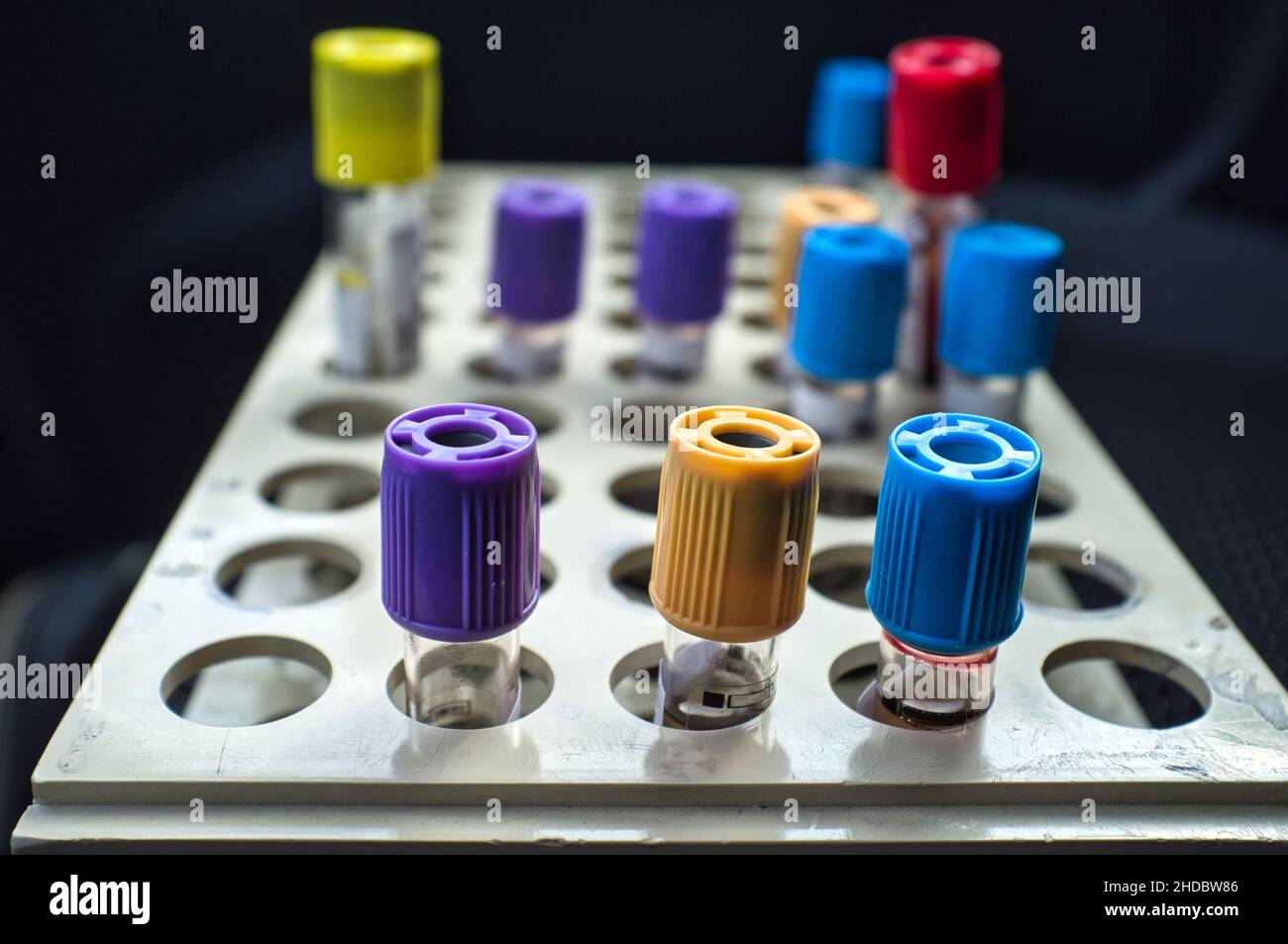 Row about test samples hi-res stock photography and images - Alamy