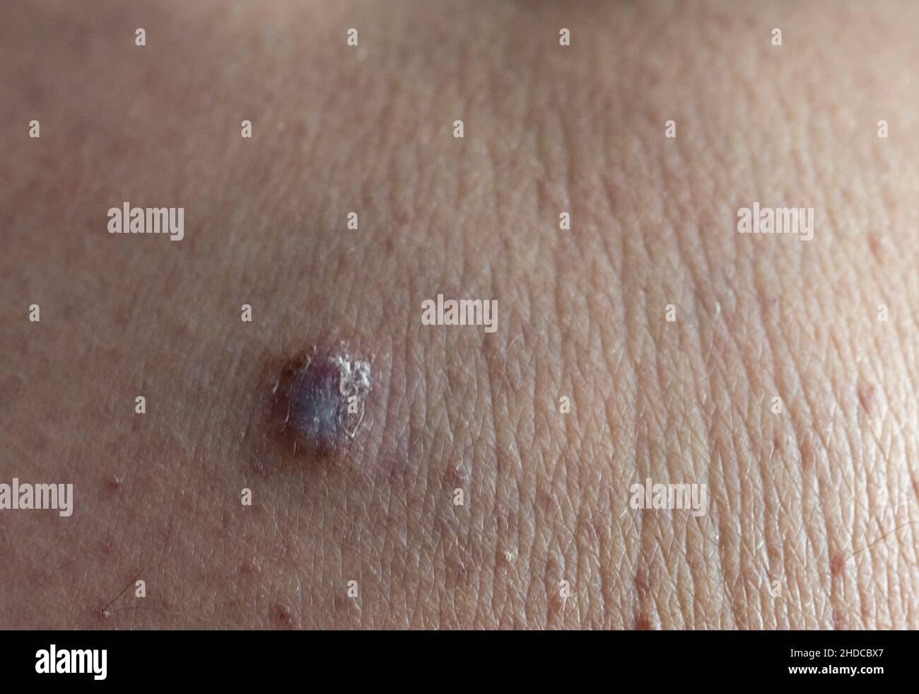 Histology of bone hi-res stock photography and images - Alamy