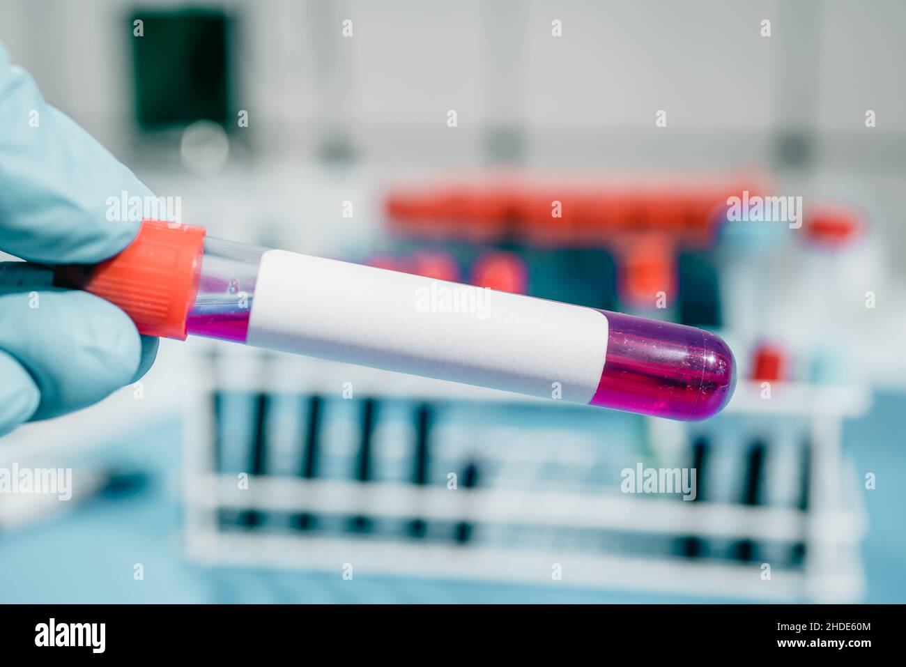 Test tube with empty label to laboratory research Stock Photo - Alamy