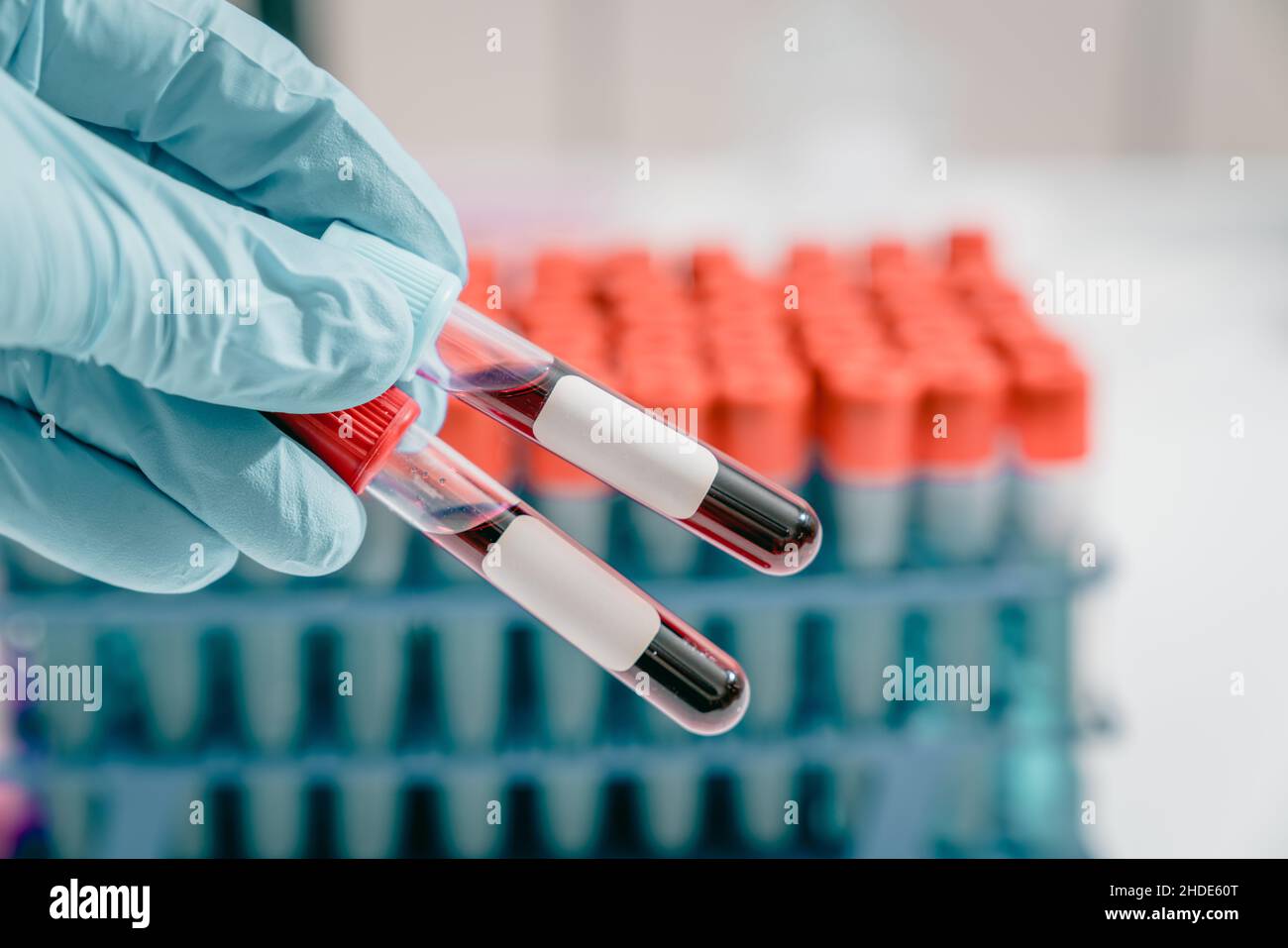 Test tube with empty label to biological sample for medical laboratory ...