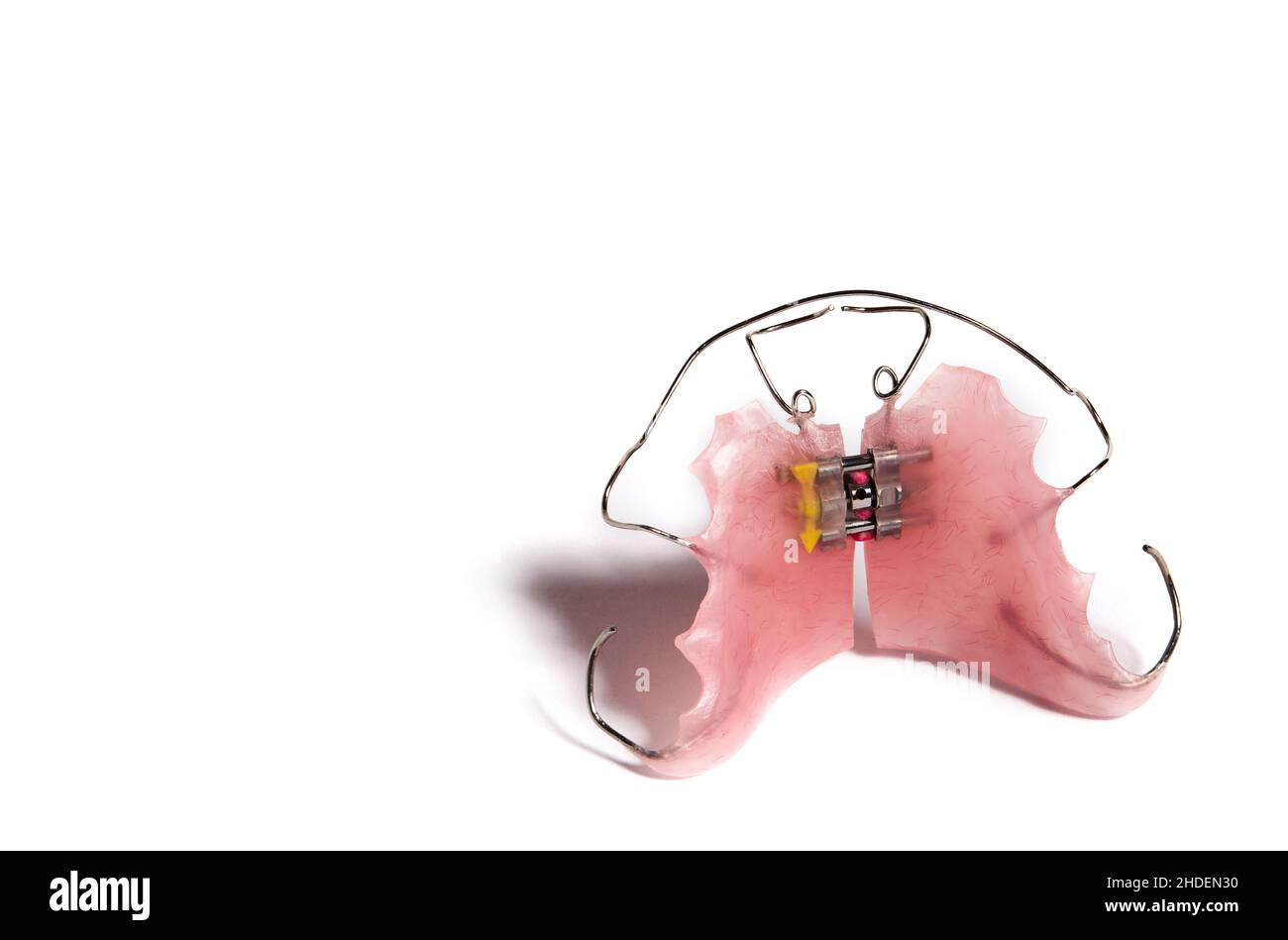Pink orthodontic teeth retainer isolated on white background Stock ...