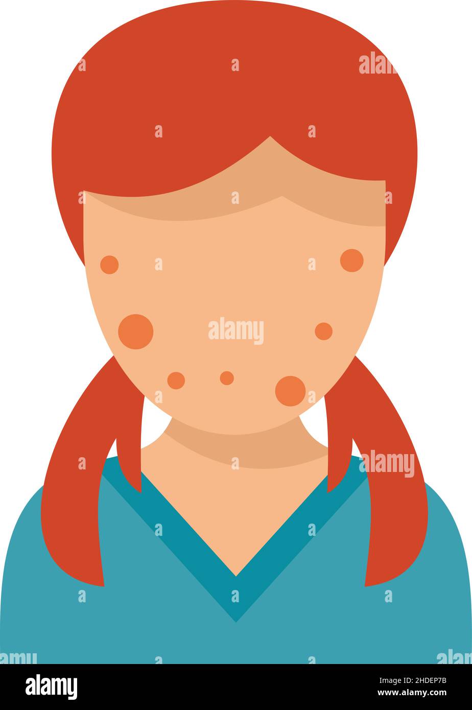 Girl face skin teen problems icon. Flat illustration of Girl face skin ...