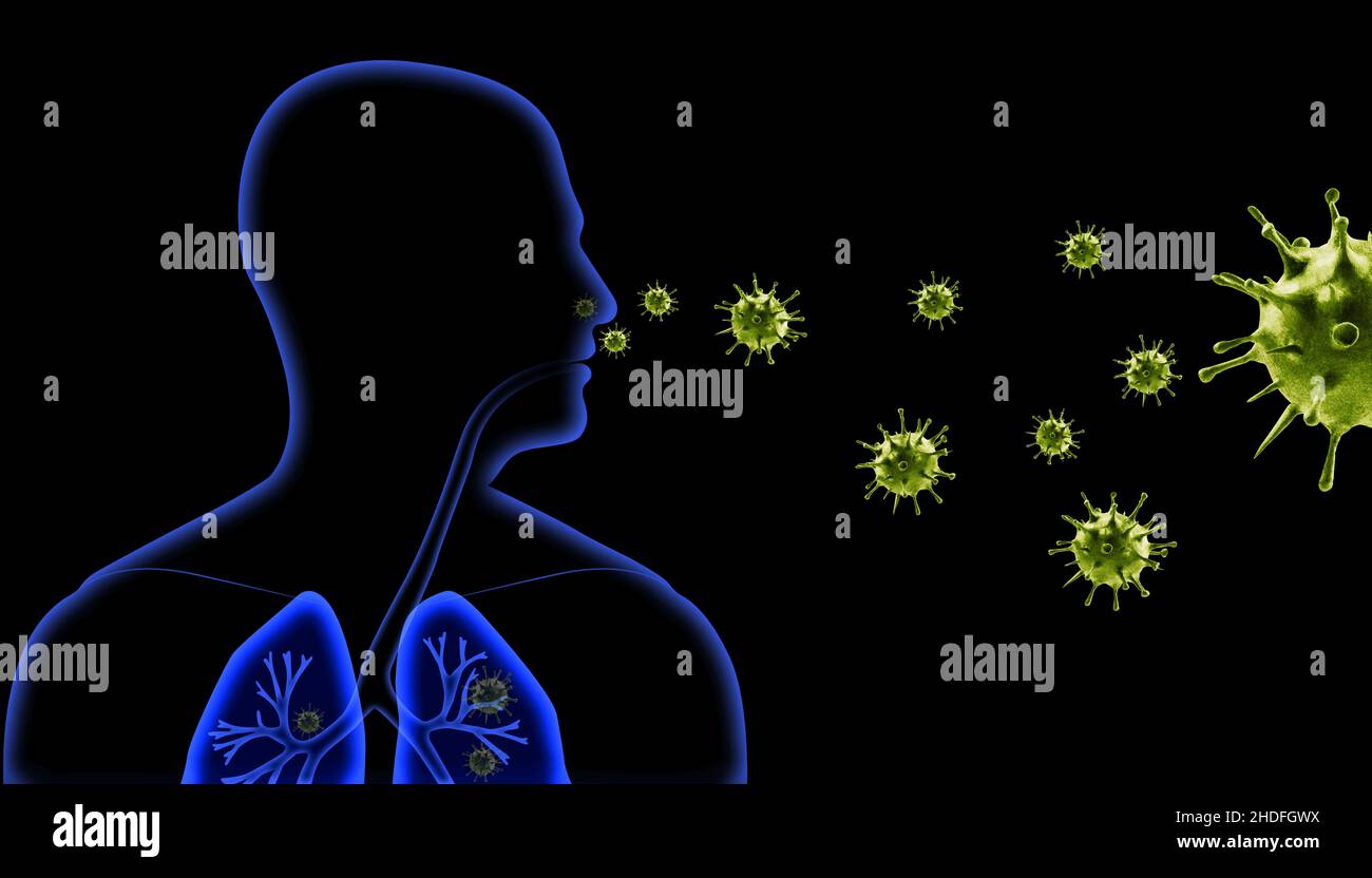 illness, virus, lung, disease, bacterium, pneumonia, corona virus, ill ...