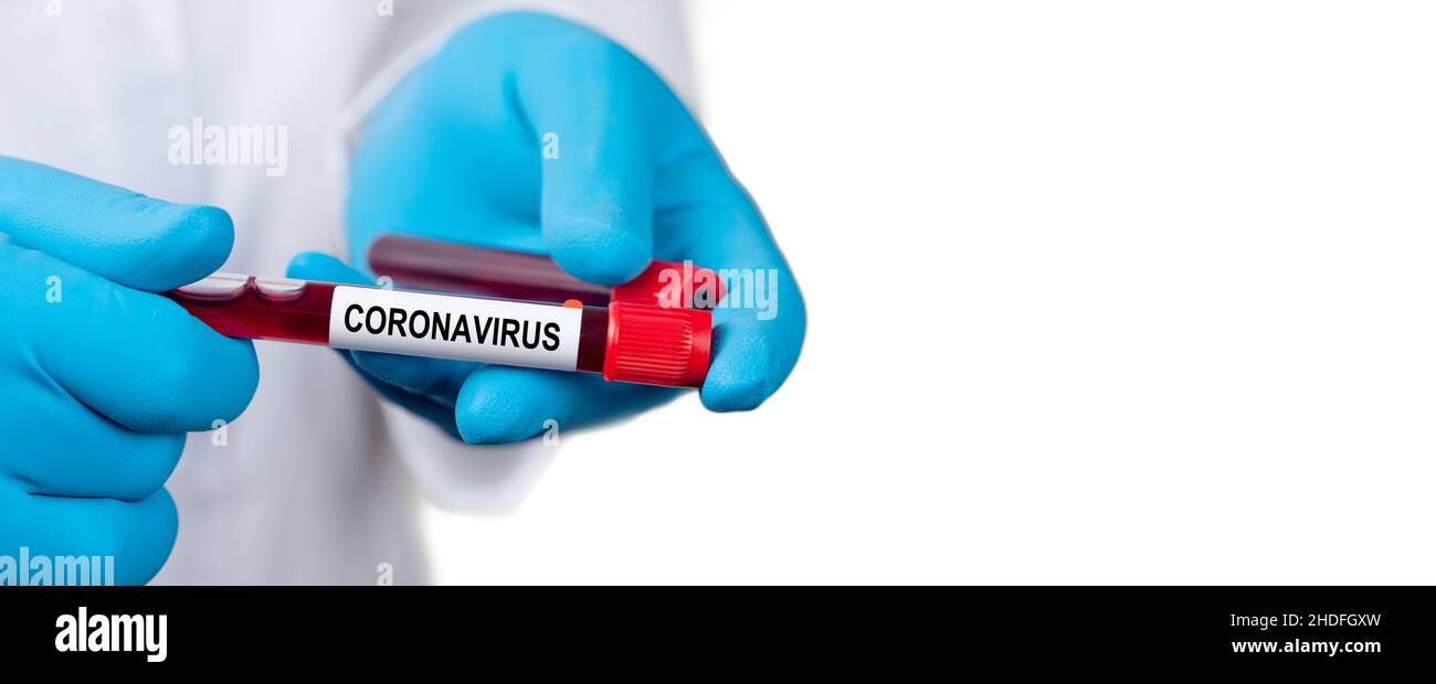 blood sample, blood examination, blood test, corona virus, blood ...