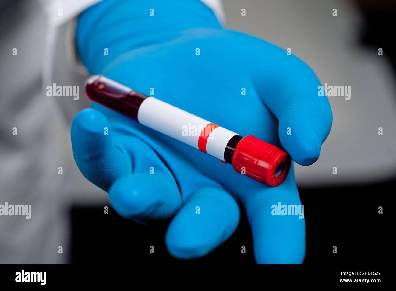 blood sample, blood examination, blood test, blood collection tube ...