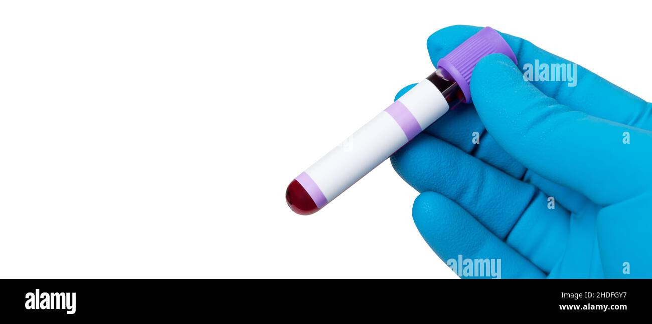 laboratory, blood sample, blood examination, blood test, blood ...