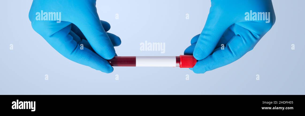 blood sample, blood examination, blood collection tube, blood samples ...