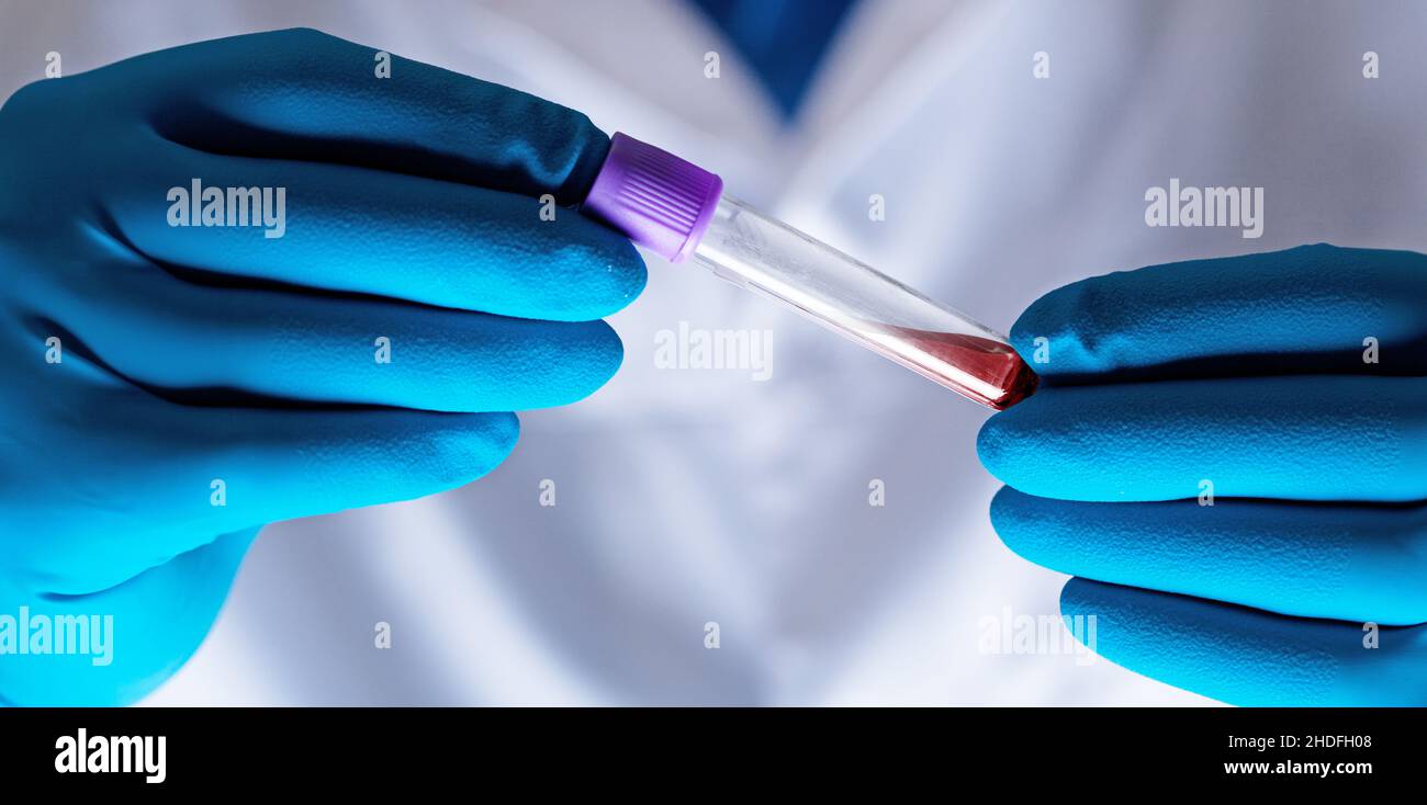 blood sample, blood test, blood collection tube, blood samples, blood ...