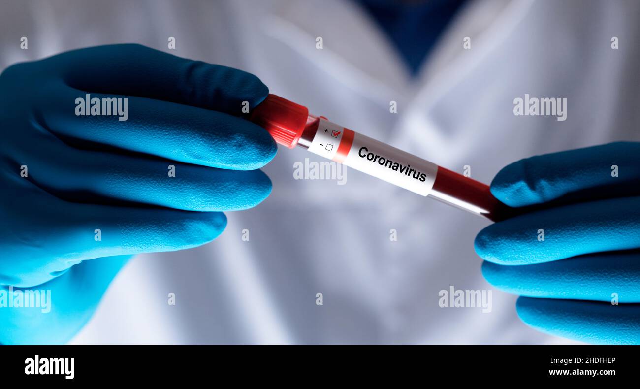 laboratory, blood sample, blood examination, corona virus, laboratories ...