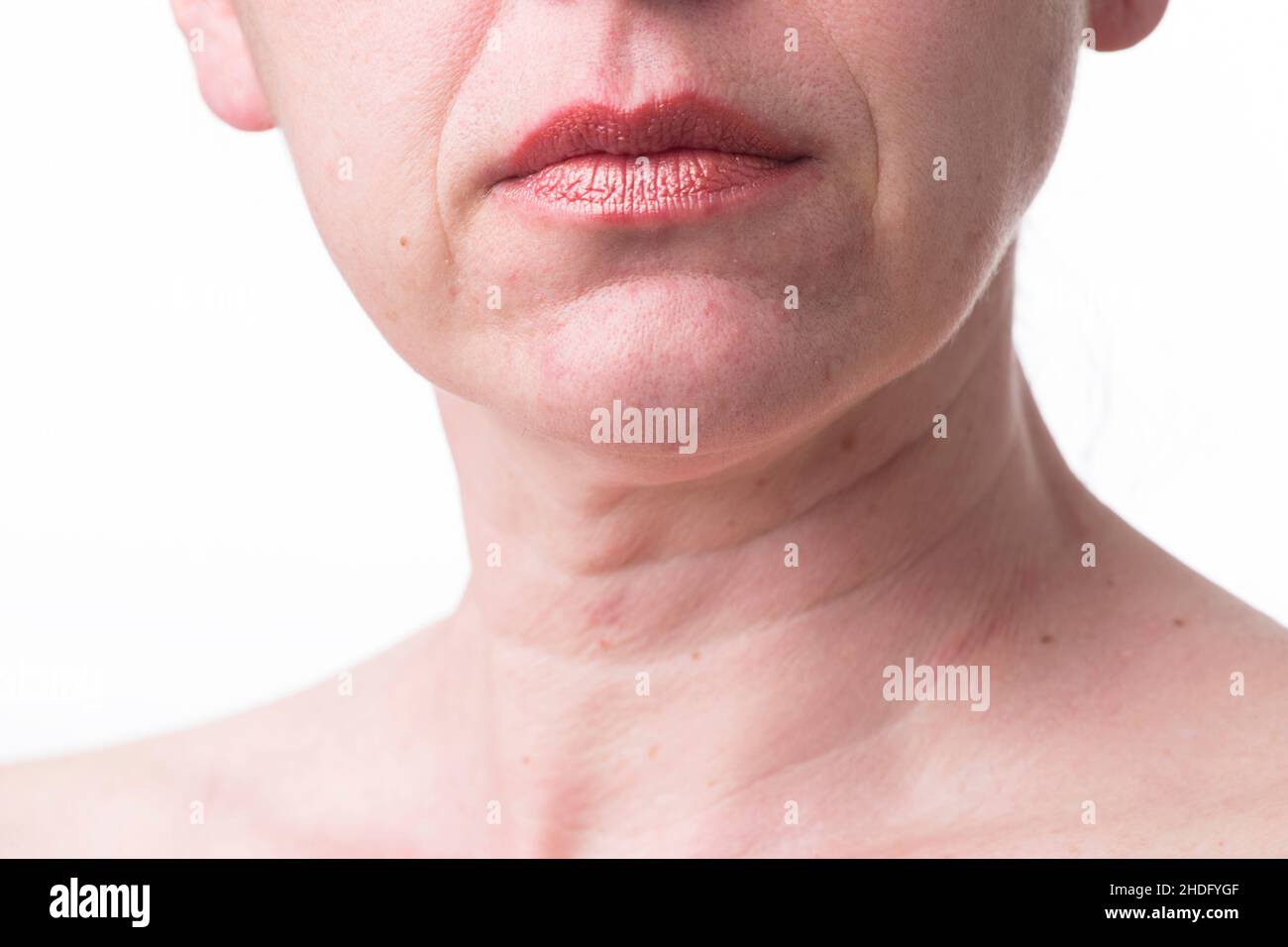 mouth, skin, folding, mouths, skins Stock Photo - Alamy